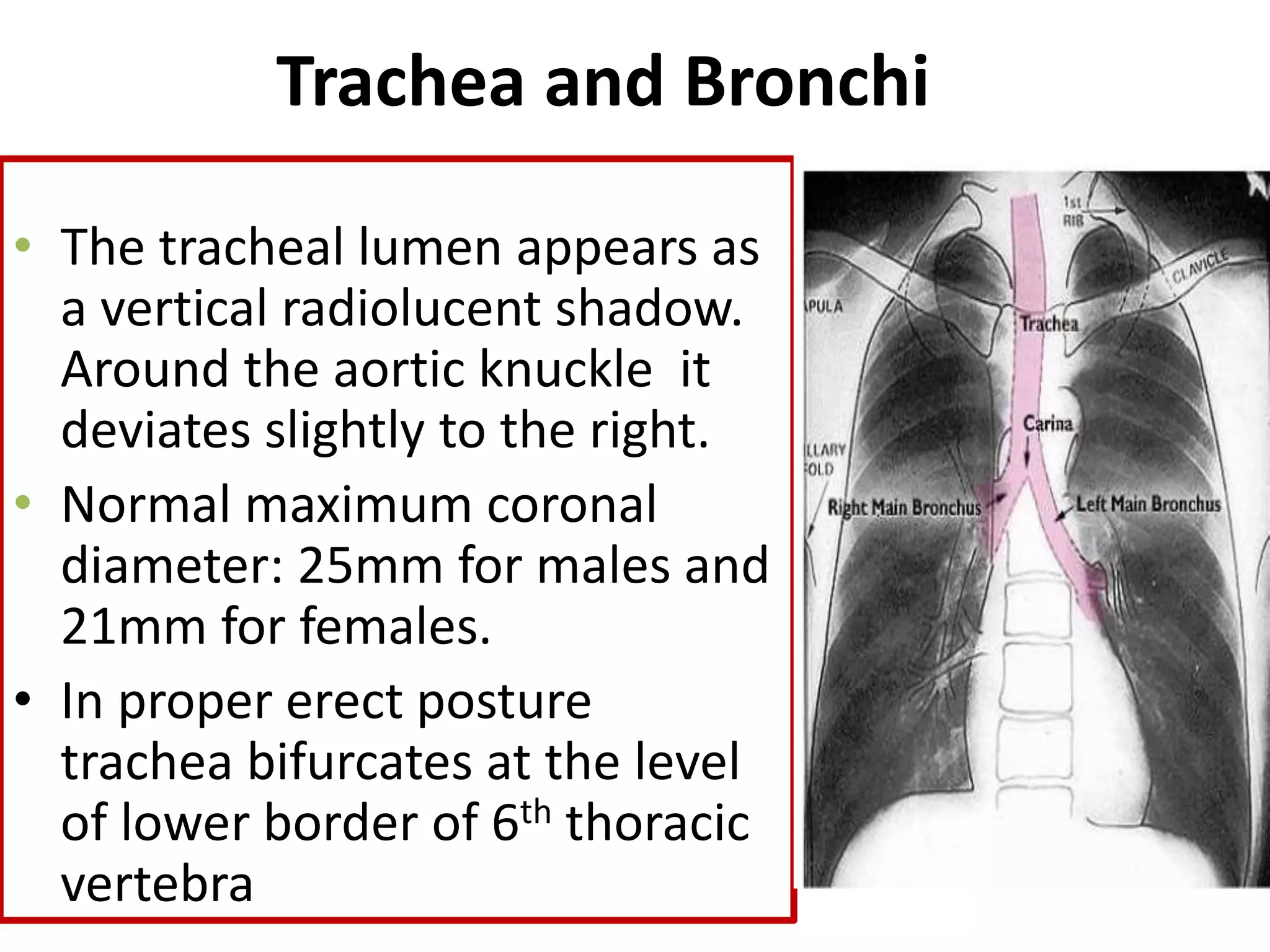 Learn Chest X-Ray With Its Normal Positioning & Radio-Anatomy | PPTX