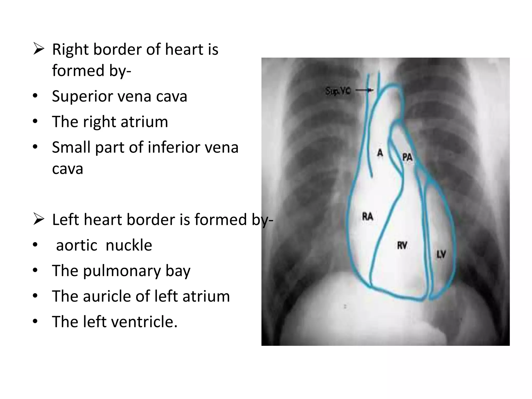 Learn Chest X-Ray With Its Normal Positioning & Radio-Anatomy | PPTX
