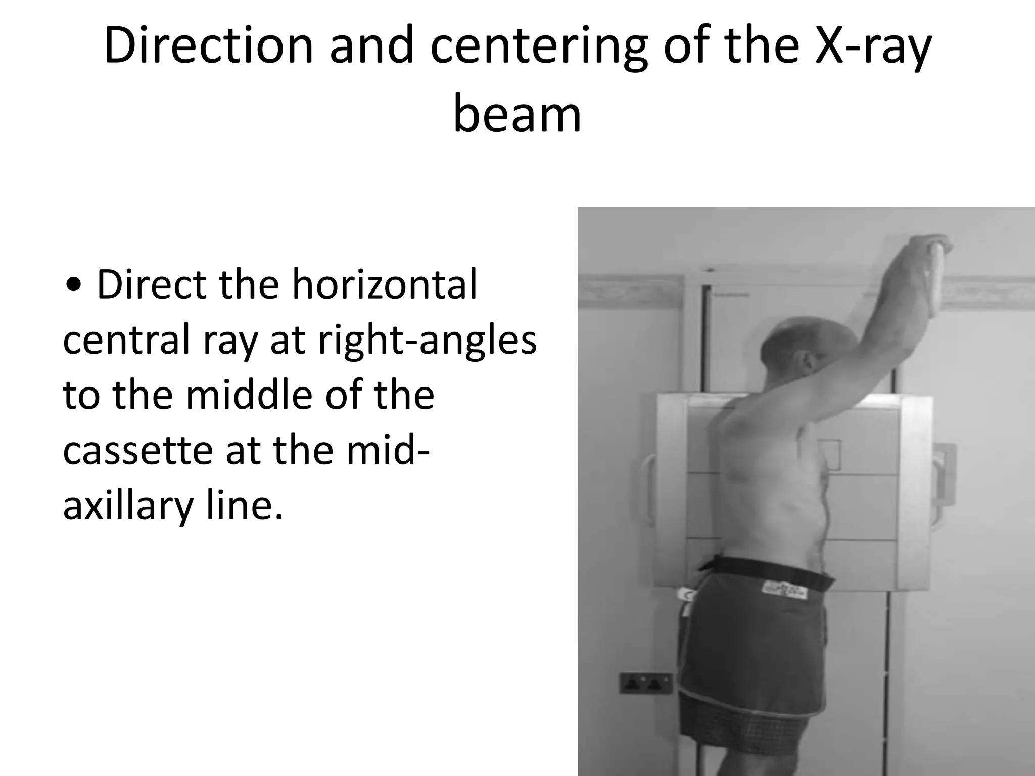 Learn Chest X-Ray With Its Normal Positioning & Radio-Anatomy | PPTX
