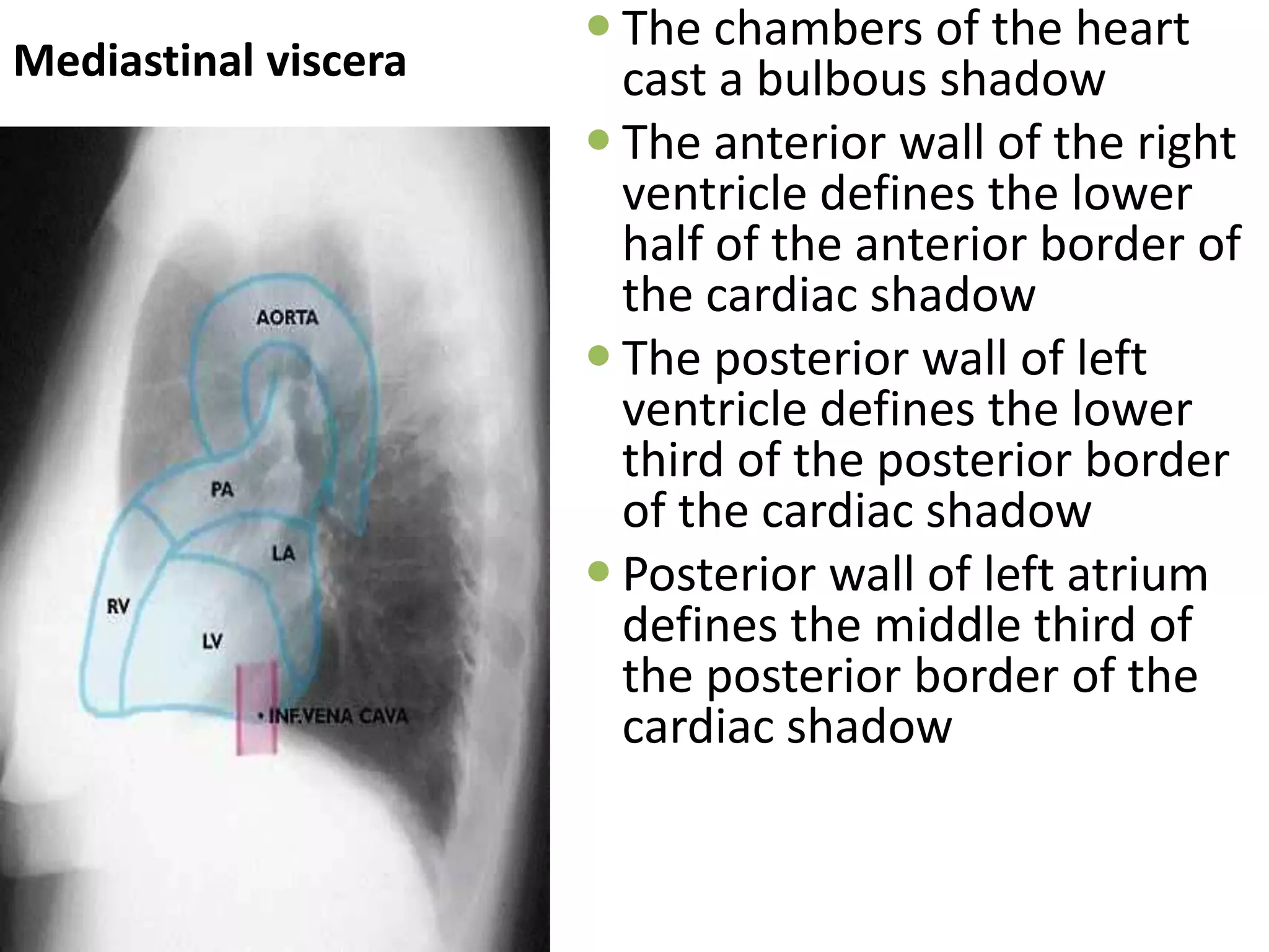 Learn Chest X-Ray With Its Normal Positioning & Radio-Anatomy | PPTX