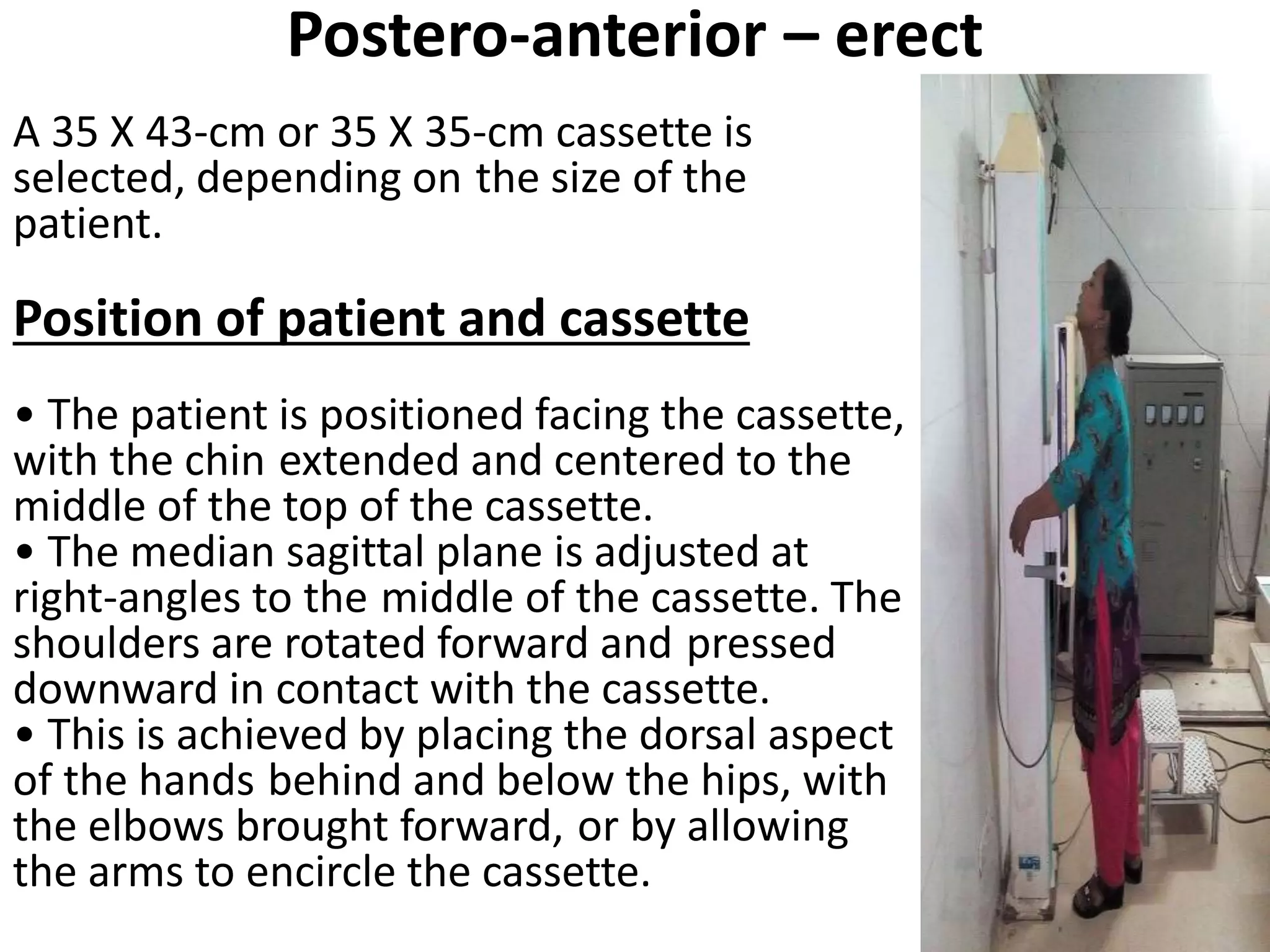 Learn Chest X-Ray With Its Normal Positioning & Radio-Anatomy | PPTX
