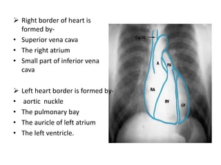 Learn Chest X-Ray With Its Normal Positioning & Radio-Anatomy | PPTX