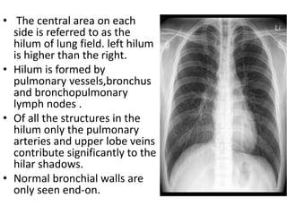 Learn Chest X-Ray With Its Normal Positioning & Radio-Anatomy | PPTX