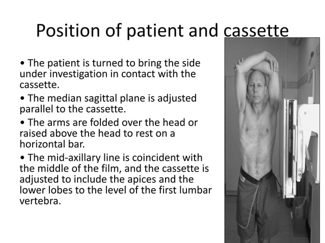 Learn Chest X-Ray With Its Normal Positioning & Radio-Anatomy | PPTX