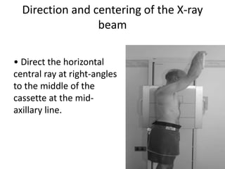 Learn Chest X-Ray With Its Normal Positioning & Radio-Anatomy | PPTX