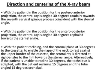 Learn Chest X-Ray With Its Normal Positioning & Radio-Anatomy | PPTX