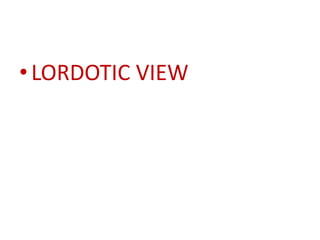 Learn Chest X-Ray With Its Normal Positioning & Radio-Anatomy | PPTX