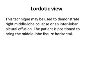 Learn Chest X-Ray With Its Normal Positioning & Radio-Anatomy | PPTX
