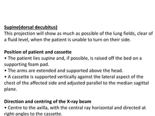 Learn Chest X-Ray With Its Normal Positioning & Radio-Anatomy | PPTX