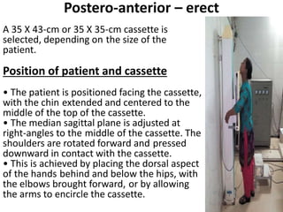 Learn Chest X-Ray With Its Normal Positioning & Radio-Anatomy | PPTX