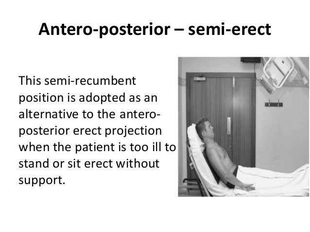 Learn Chest X-Ray With Its Normal Positioning & Radio-Anatomy