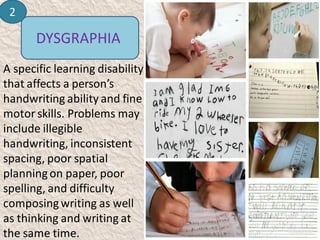 Learning disabled child | PPT