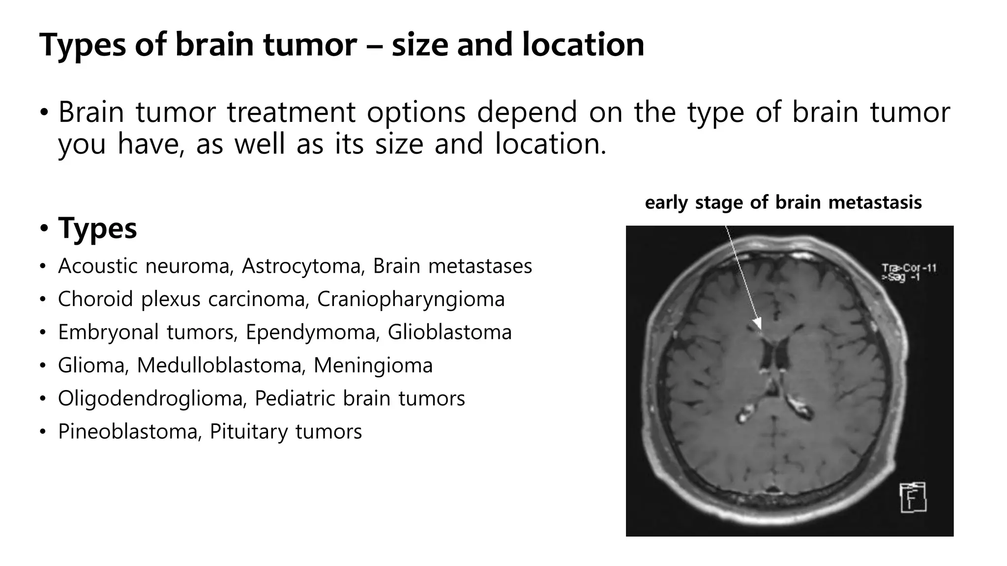 Learning to learn unlearned feature for segmentation | PPT