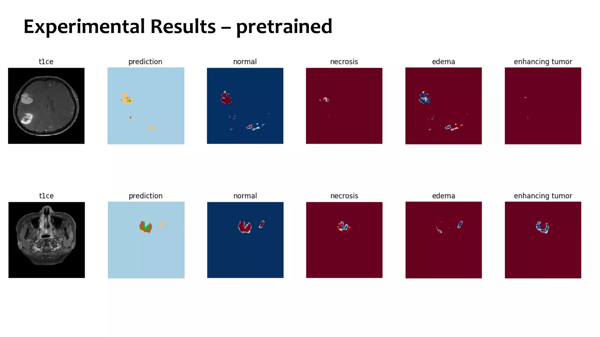 Learning to learn unlearned feature for segmentation | PPT