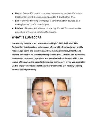 Learn the benefits of the Lumecca IPL Skin Rejuvenation.docx