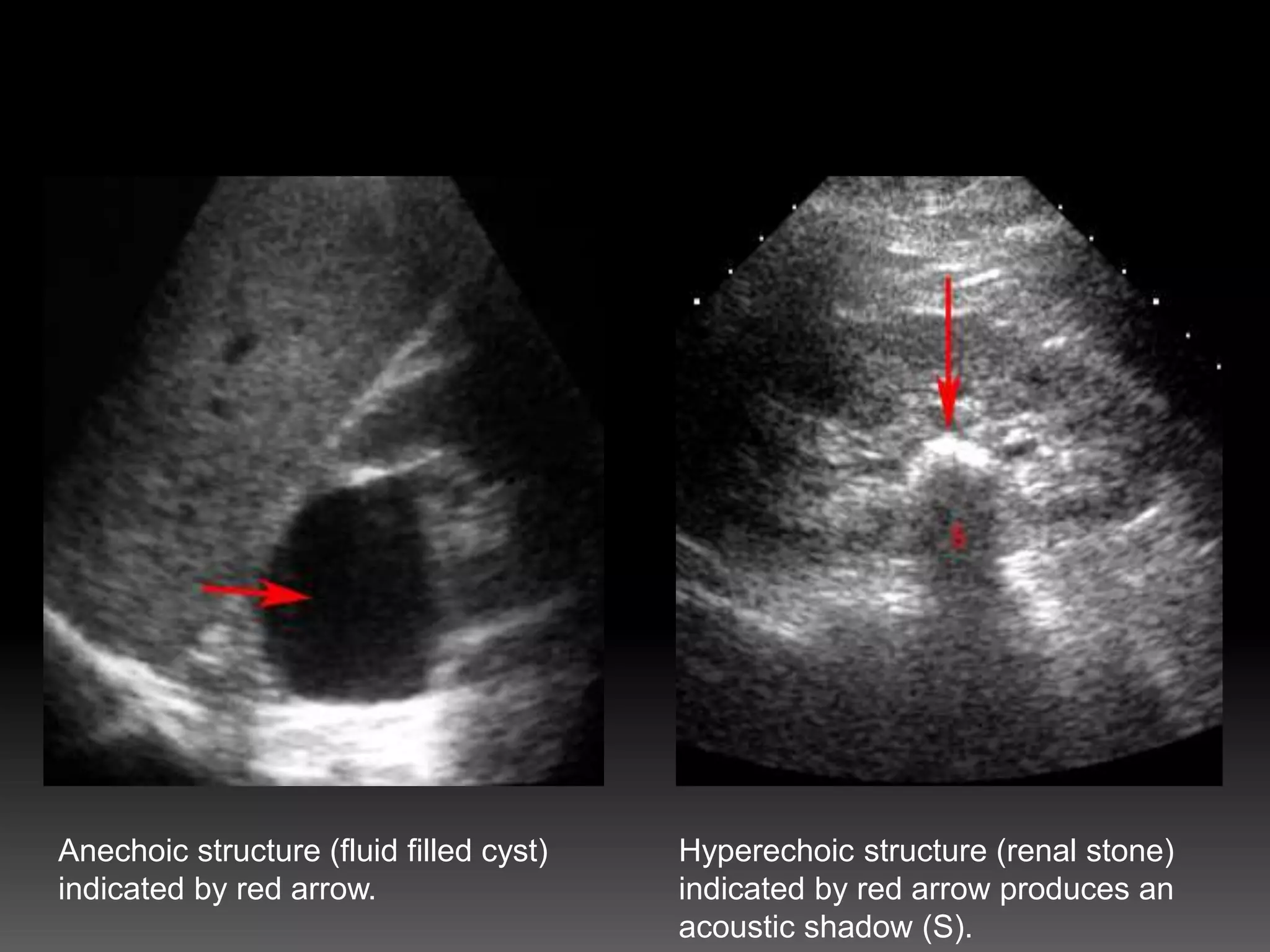 Learn ultrasonography | PPTX