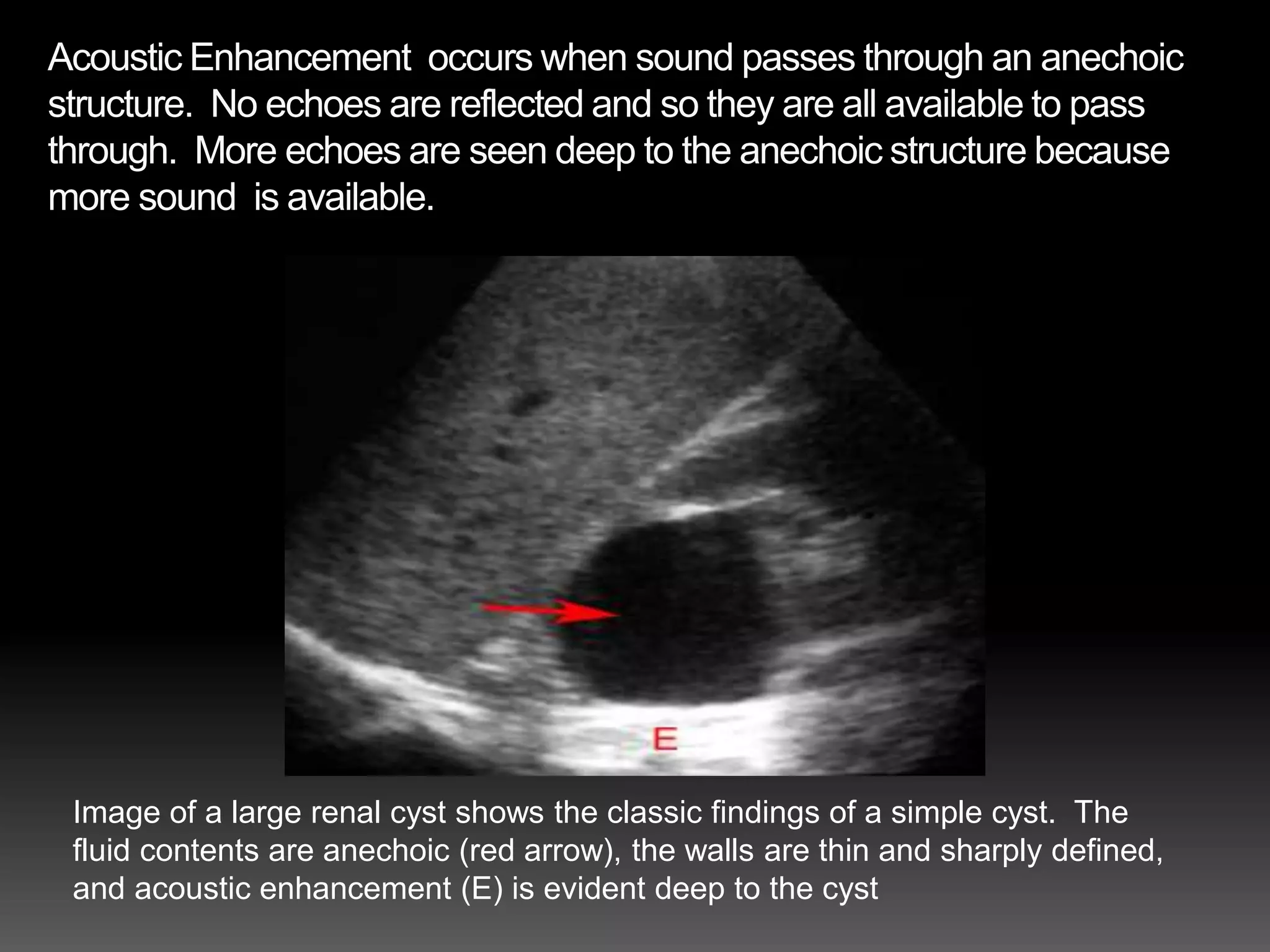 Learn ultrasonography | PPTX