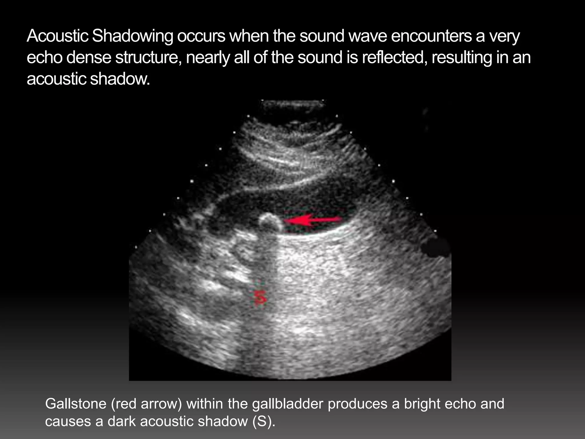 Learn ultrasonography | PPTX