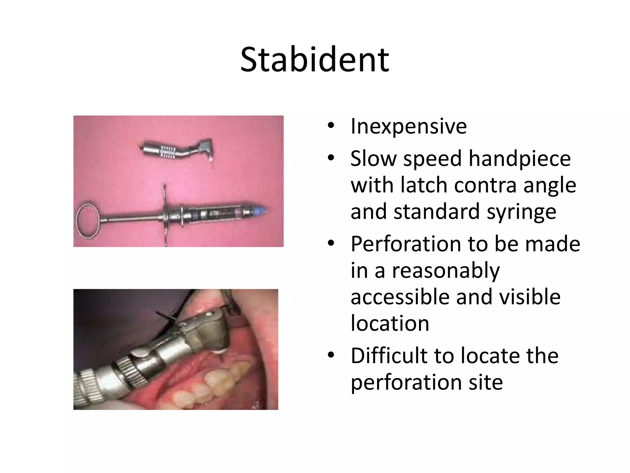Newer techniques in local anesthesia delivery systems | PPTX