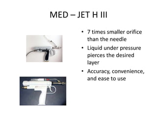 Newer techniques in local anesthesia delivery systems | PPTX