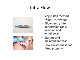 Newer techniques in local anesthesia delivery systems | PPTX