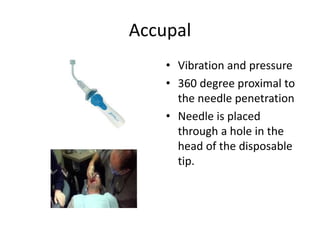Newer techniques in local anesthesia delivery systems | PPTX