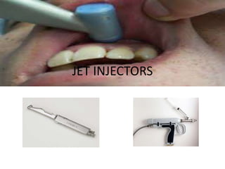 Newer techniques in local anesthesia delivery systems | PPTX