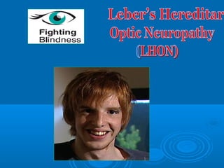 Leber hereditary optic neuropathy | PPT