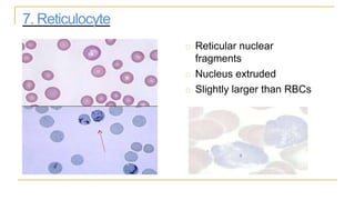 Lec-1.-Erythropoiesis and it's stages with fate of rbc | PDF