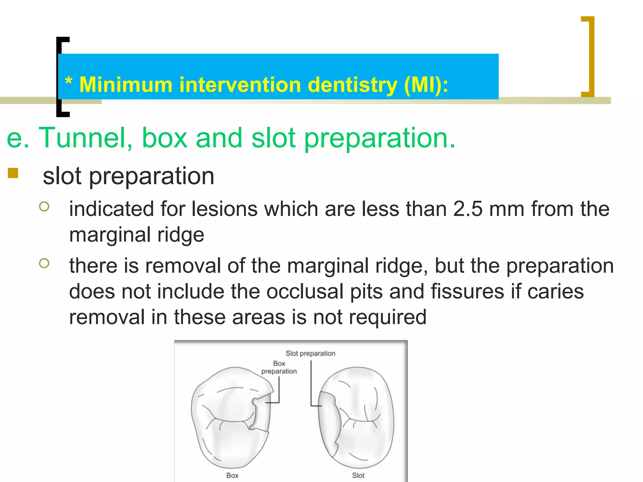 minimal intervension dentistry | PPT