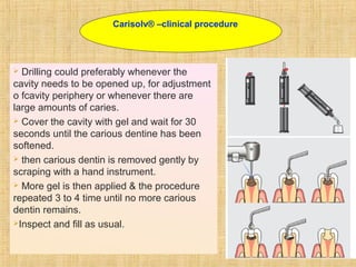 minimal intervension dentistry | PPT