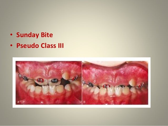 orthodontic diagnosis - Examination history
