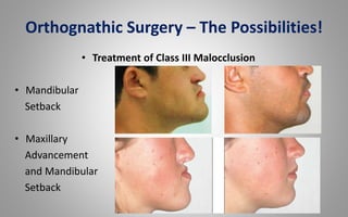 Lec. 07. skeletal and dental maturity indicators | PPTX
