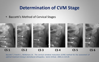Lec. 07. skeletal and dental maturity indicators | PPT