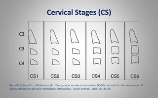 Lec. 07. skeletal and dental maturity indicators | PPT