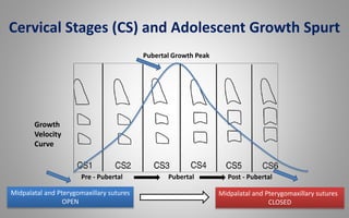 Lec. 07. skeletal and dental maturity indicators | PPT
