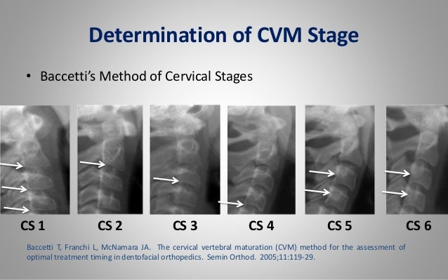 Lec. 07. skeletal and dental maturity indicators