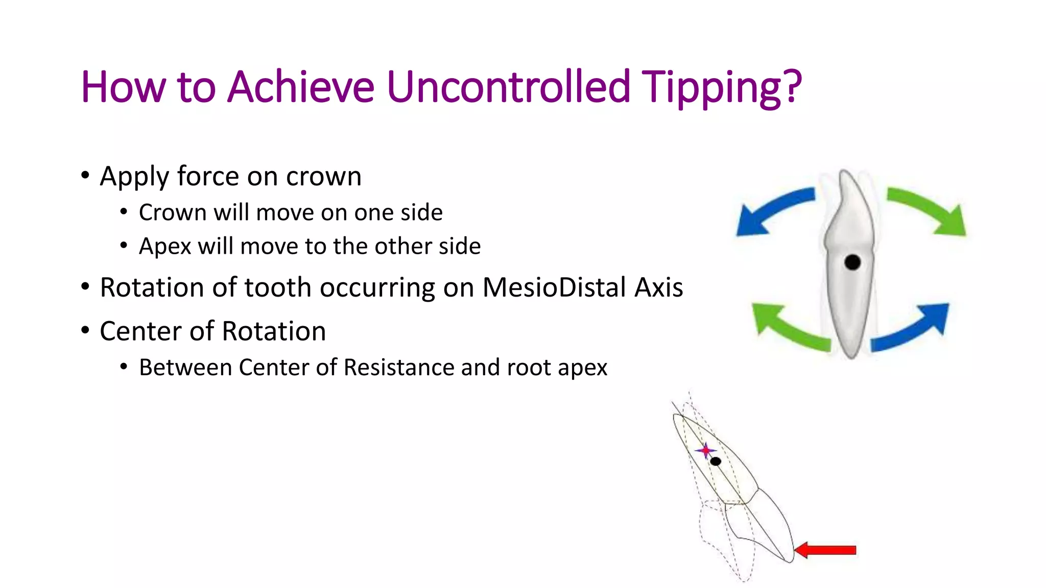 basics of orthodontic force system | PPTX