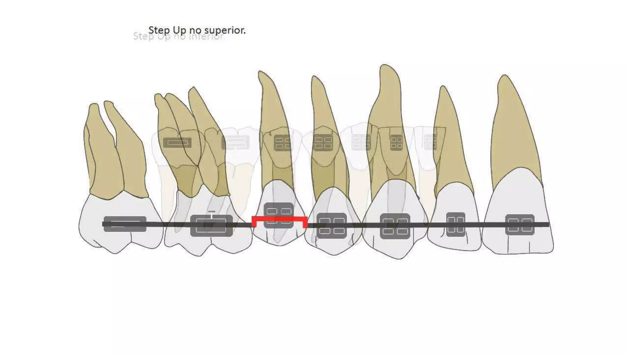 basics of orthodontic force system | PPTX