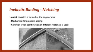 mechanical aspects of anchorage control | PPTX