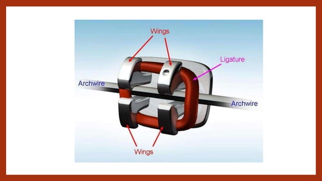 mechanical aspects of anchorage control | PPTX