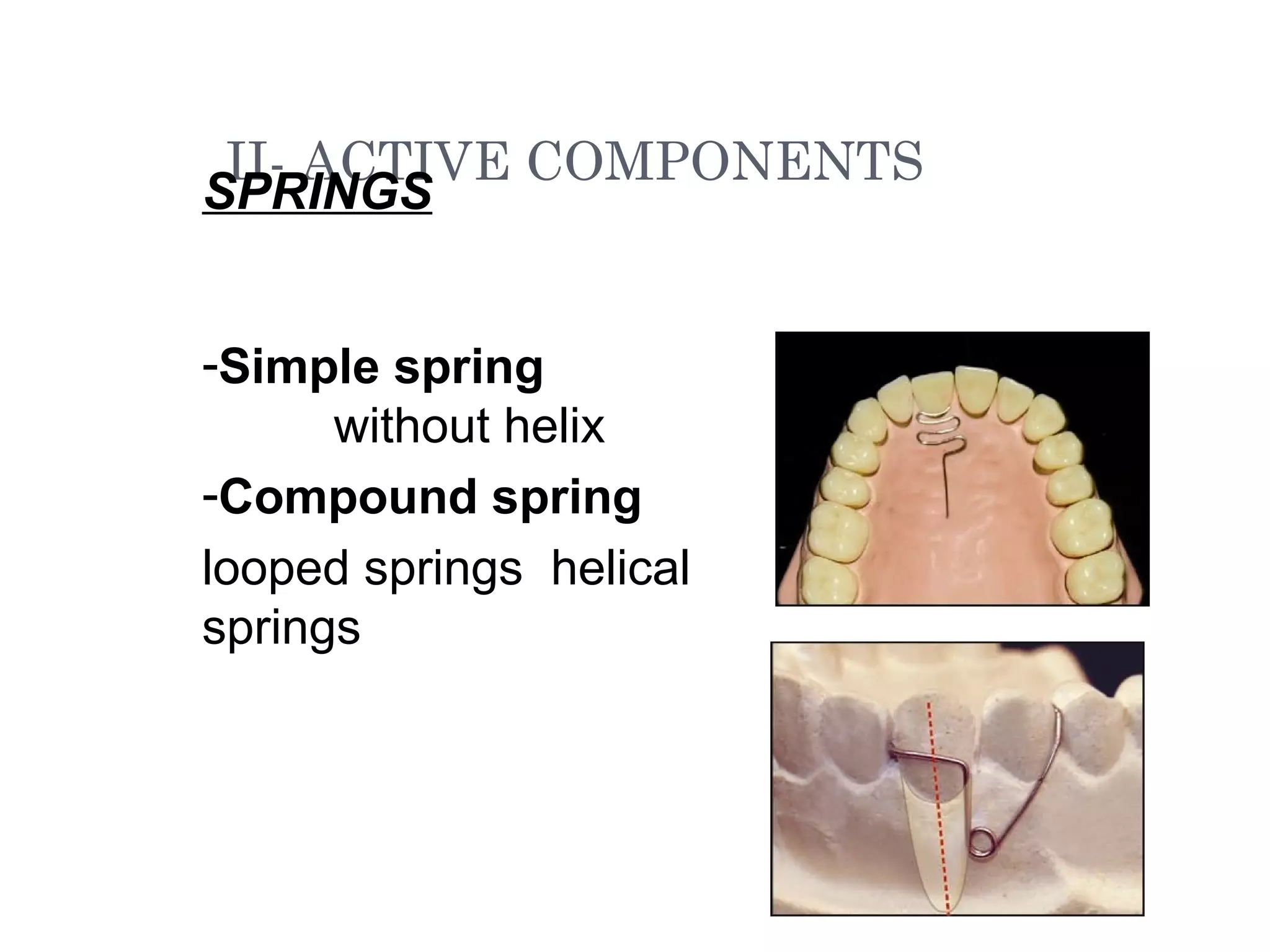 removable orthodontic appliances | PPT