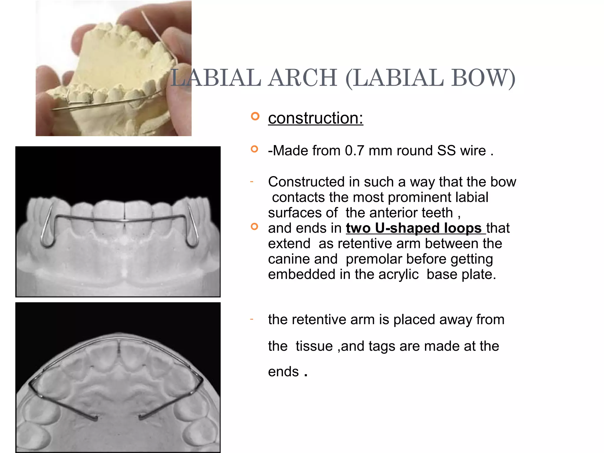 removable orthodontic appliances | PPT