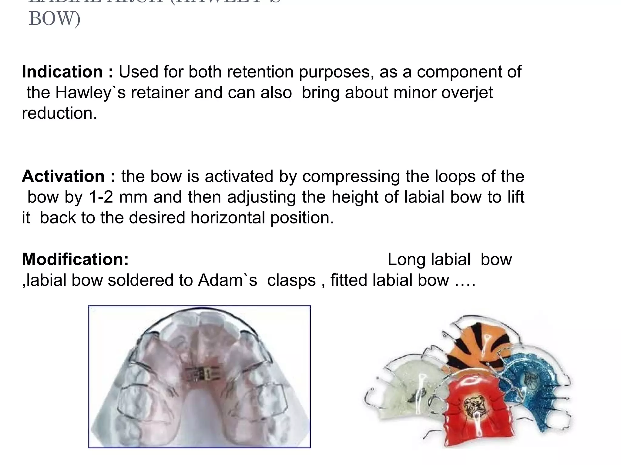 removable orthodontic appliances | PPT