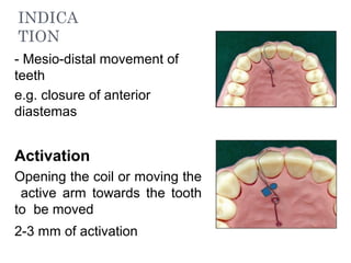 removable orthodontic appliances | PPT