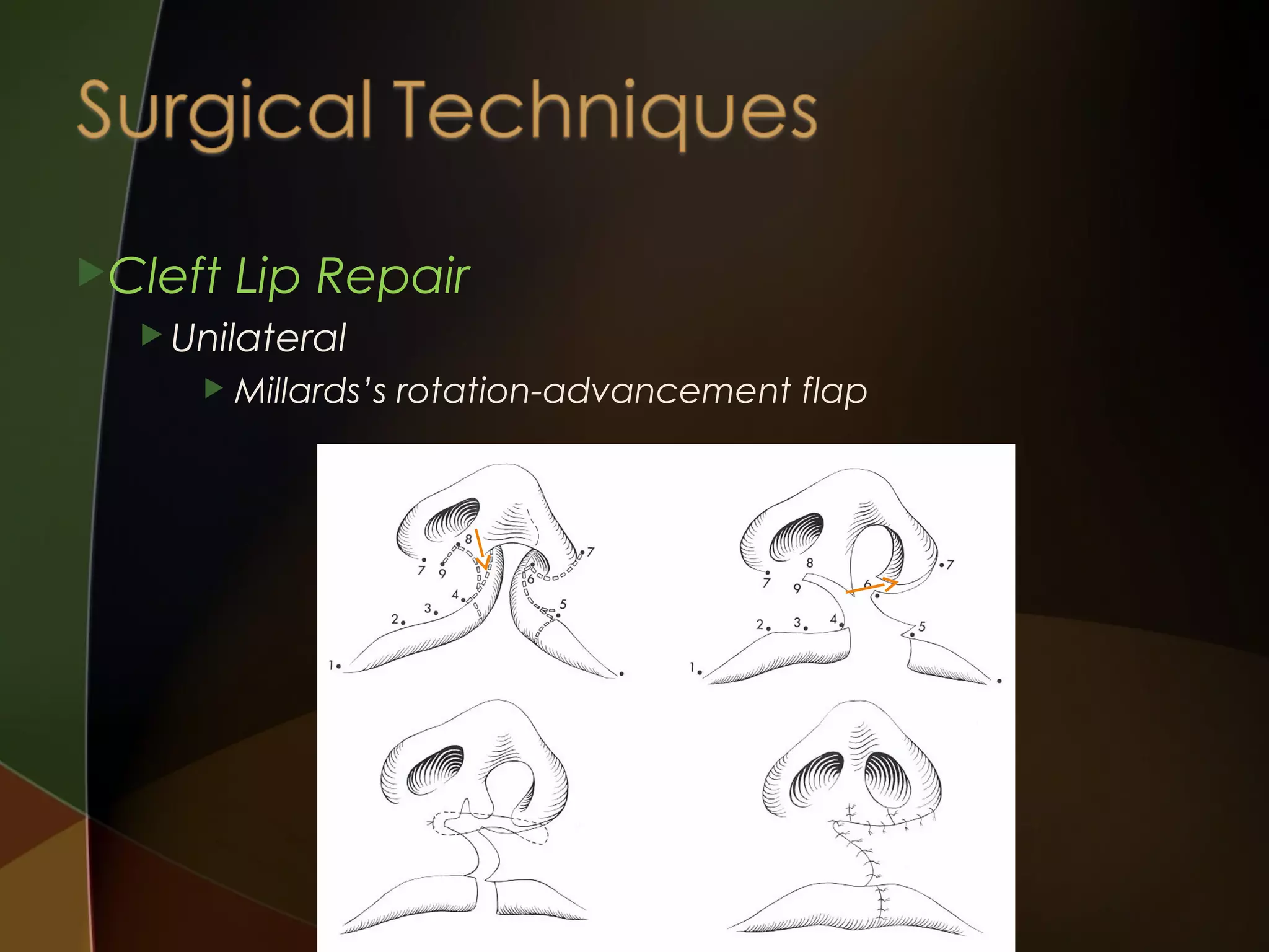 Cleft lip and palate - Introduction and Orthodontic Considerations | PPT