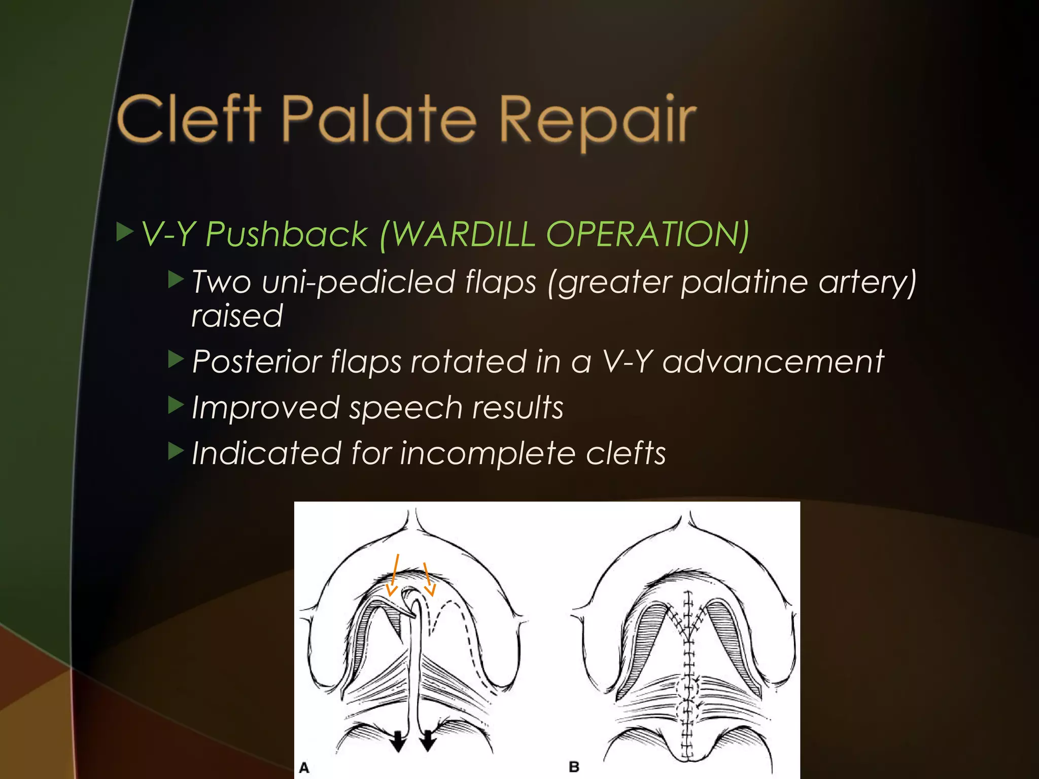 Cleft lip and palate - Introduction and Orthodontic Considerations | PPT