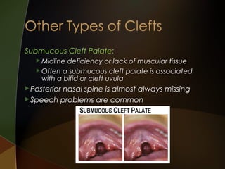 Cleft lip and palate - Introduction and Orthodontic Considerations | PPT
