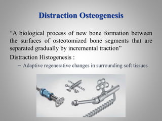 surgical interventions in orthodontics | PPTX