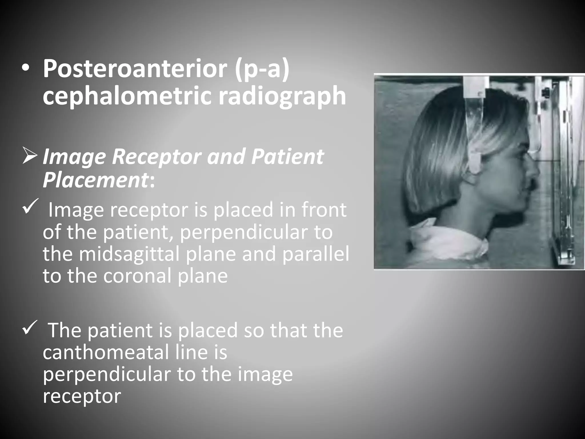 lateral cephalometry in orthodontics | PPTX